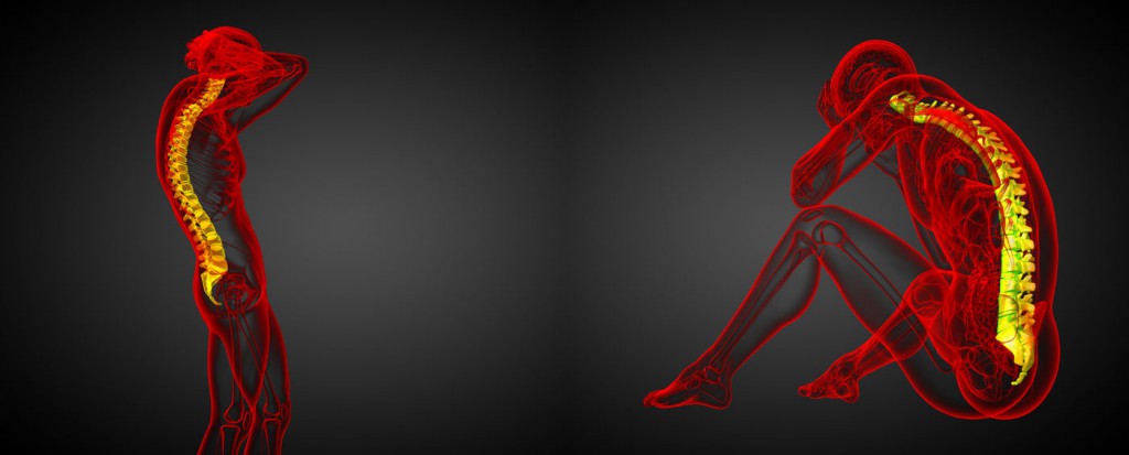 Lumbalgia: causas, prevención y tratamiento | ICONICA Servicios Médicos