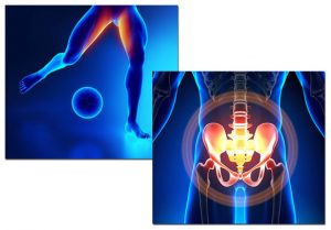 Pubalgia: causas, síntomas, tratamiento y ejercicios | ICONICA ...