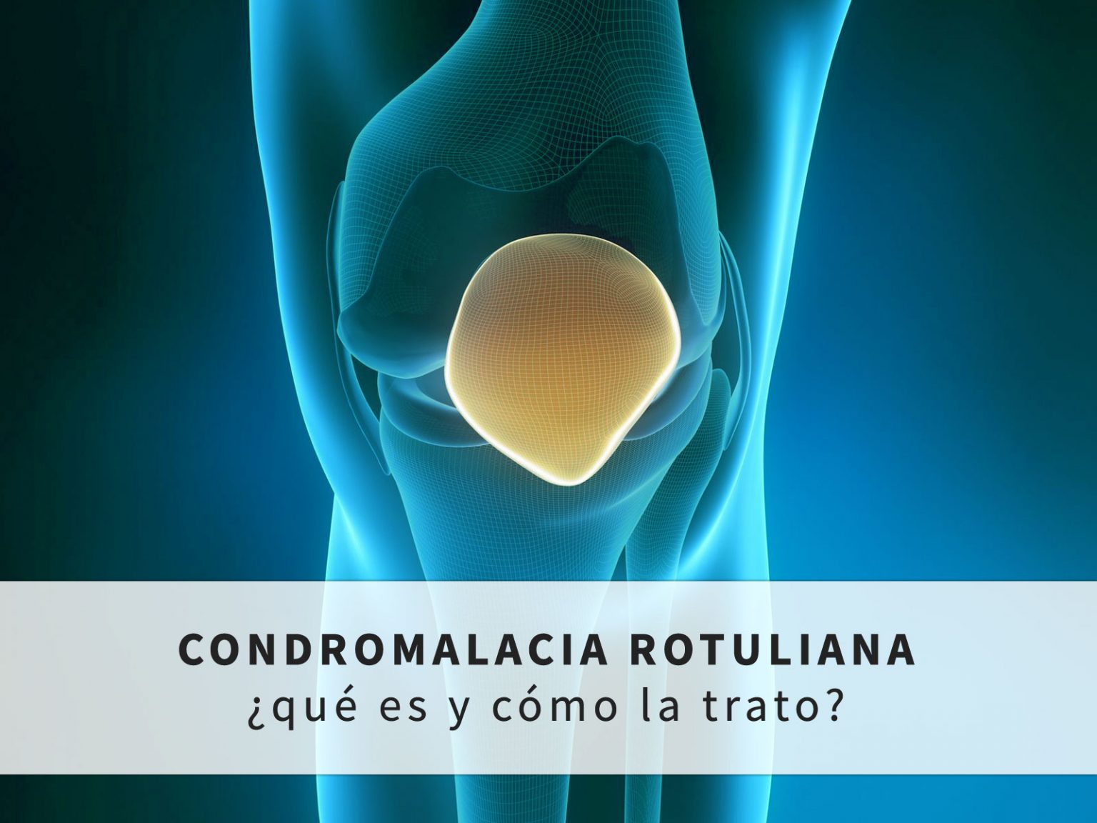 tendon rotuliano | ICONICA Servicios Médicos