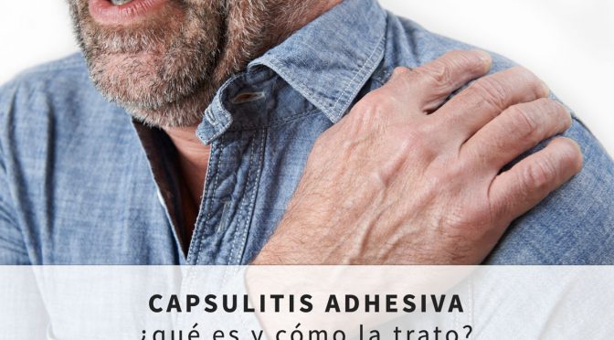 ¿Qué es y cómo tratar la Capsulitis Adhesiva? | ICONICA Servicios Médicos